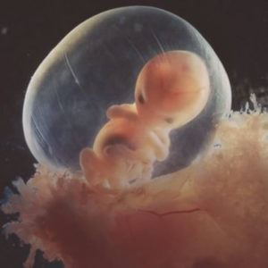 Anencefalia: O que é, Causas, Características e Tratamentos - Cannalize