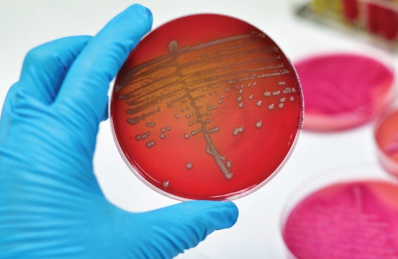 Septicemia (Sepse): O que é, Causas, Sintomas e Tratamentos - Cannalize